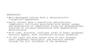 LECTURE Acute Inflammatory Skin Lesions.pdf