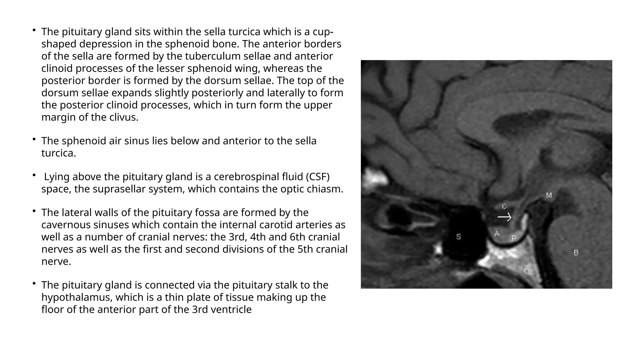 Radiological features of Pituitary adenomas | PPTX