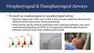 2 Airway Management.pptx
