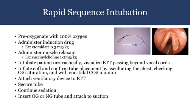 2 Airway Management.pptx