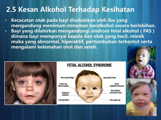 2 : Alkohol Dan Kesannya Kepada Kesihatan | PPTX