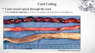 amnion_and_umbilical_cord power point presentation | PPT