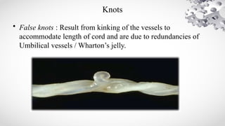 amnion_and_umbilical_cord power point presentation | PPT