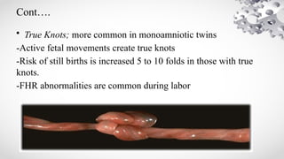 amnion_and_umbilical_cord power point presentation | PPT