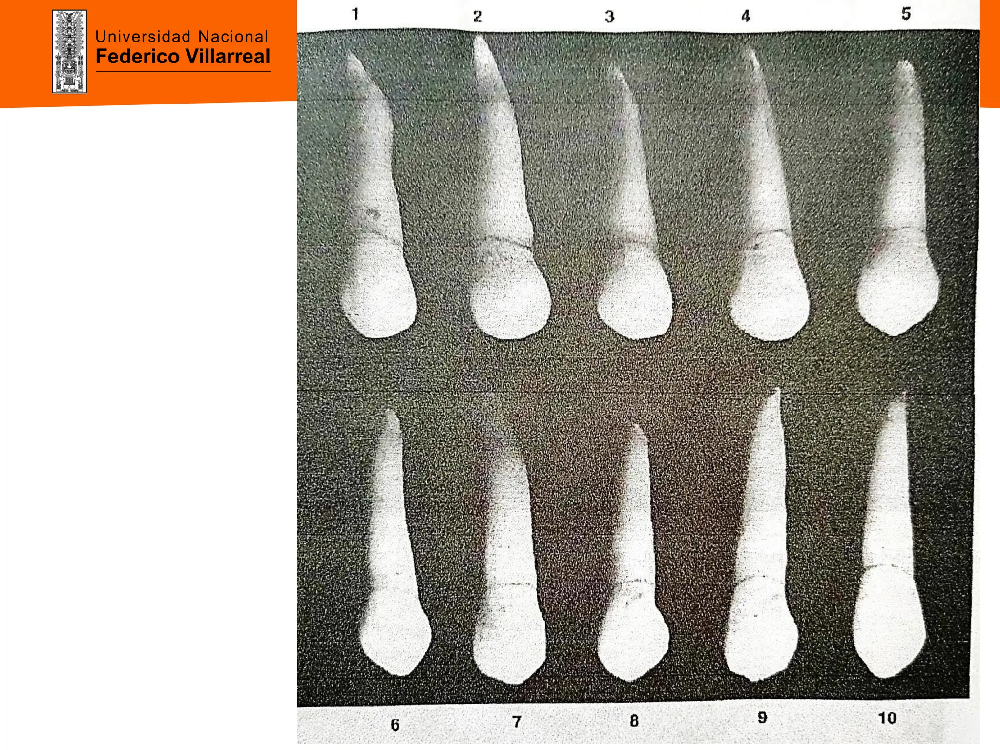 2 ANATOMIA-DENTAL-SECTOR-ANTERO-SUPERIOR nivelacion .pdf