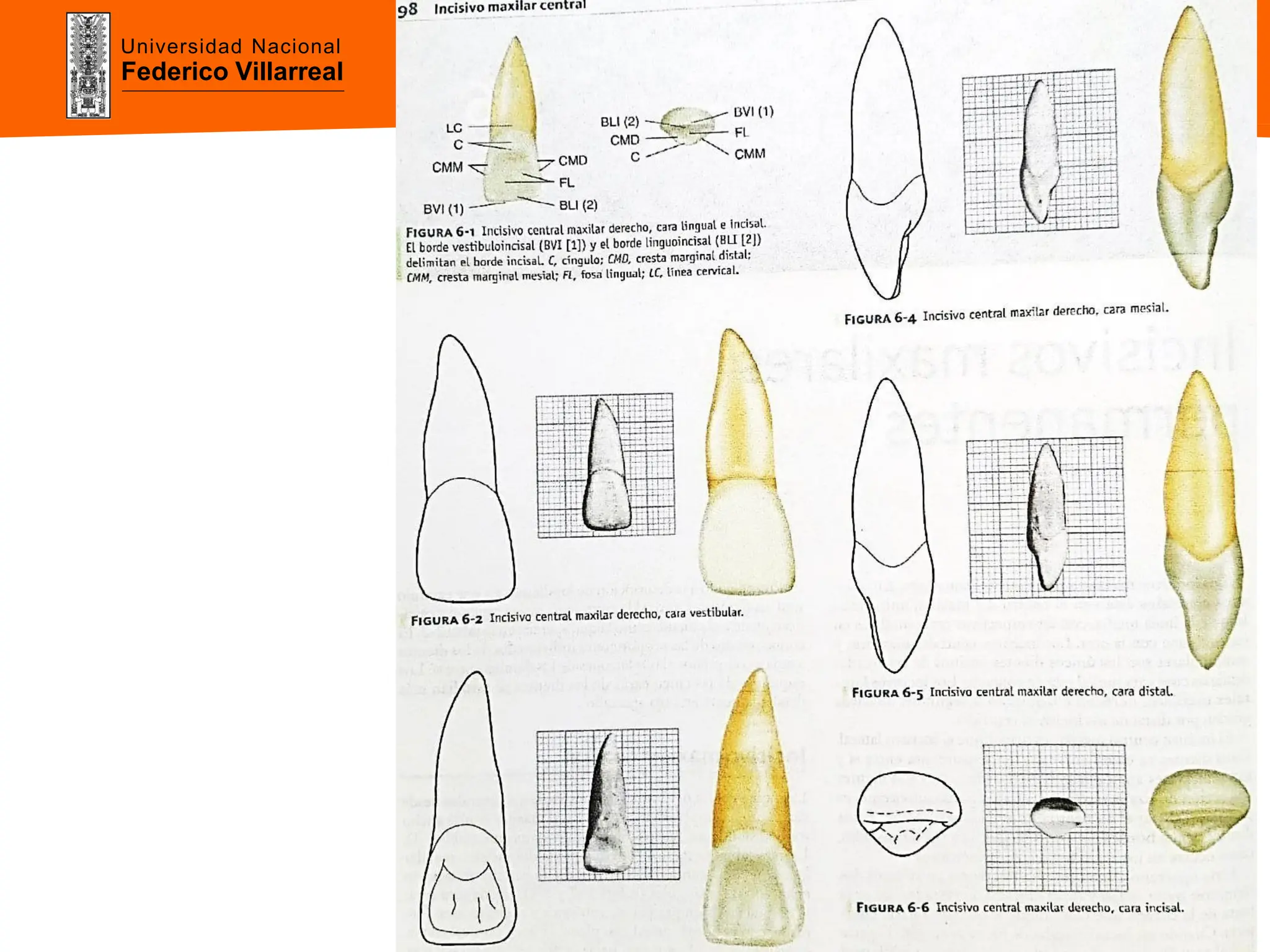 2 ANATOMIA-DENTAL-SECTOR-ANTERO-SUPERIOR nivelacion .pdf