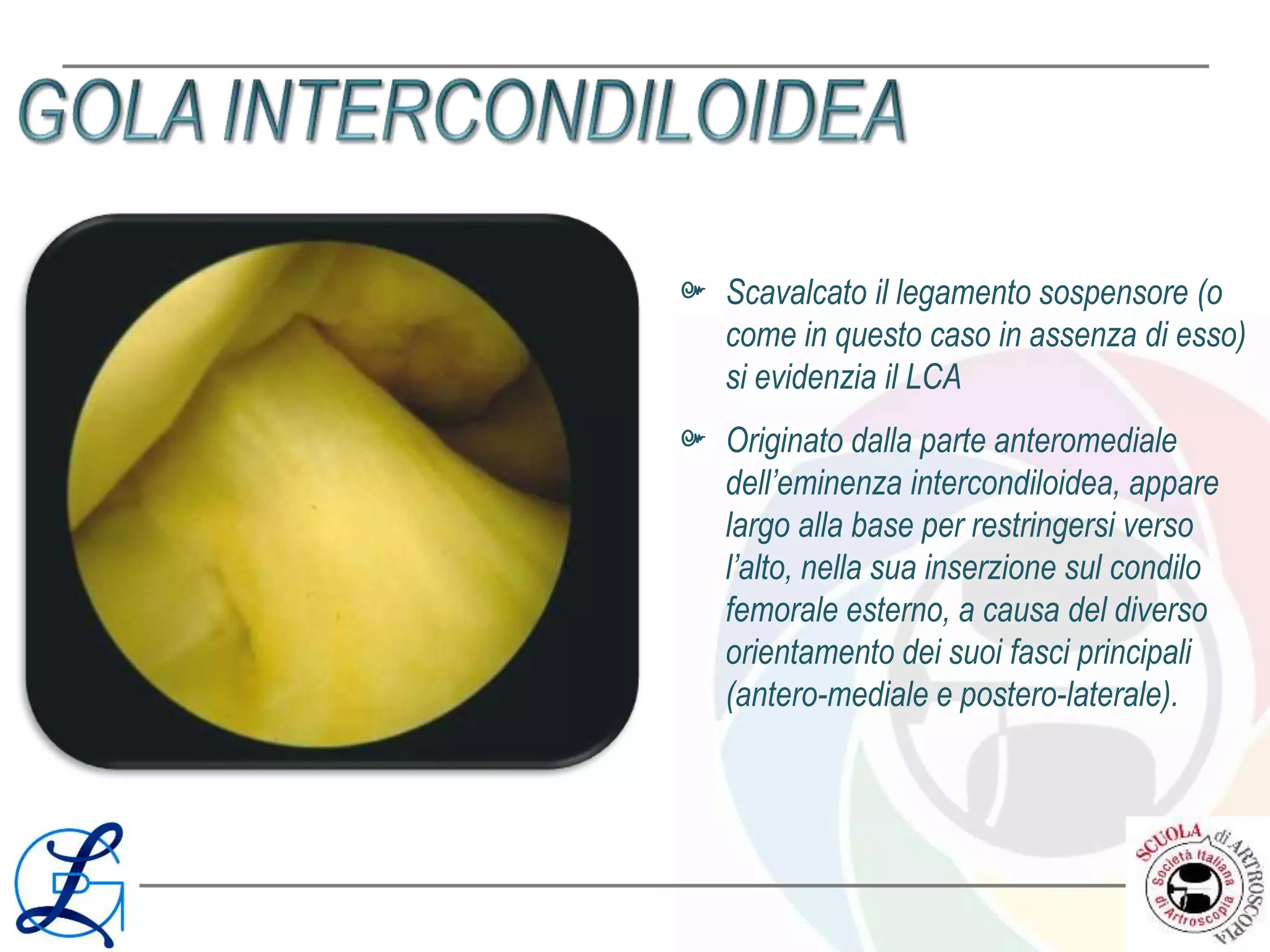 Anatomia artroscopica di ginocchio | PPSX