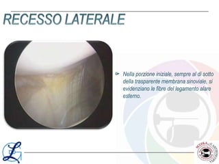 Anatomia artroscopica di ginocchio | PPSX