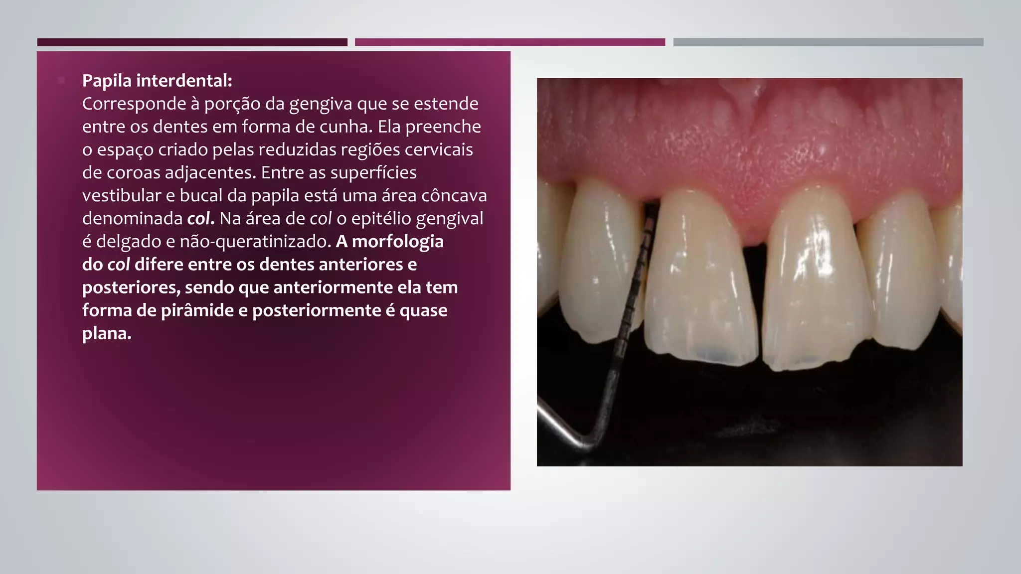 2 ANATOMIA E HISTOLOGIA DO PERIODONTO.pptx | Dental Health | Diseases ...