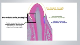 2 ANATOMIA E HISTOLOGIA DO PERIODONTO.pptx | Dental Health | Diseases ...