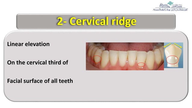 2= Anatomical landmarks and dental tissues.pptx | Dental Health ...