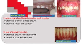 2= Anatomical landmarks and dental tissues.pptx