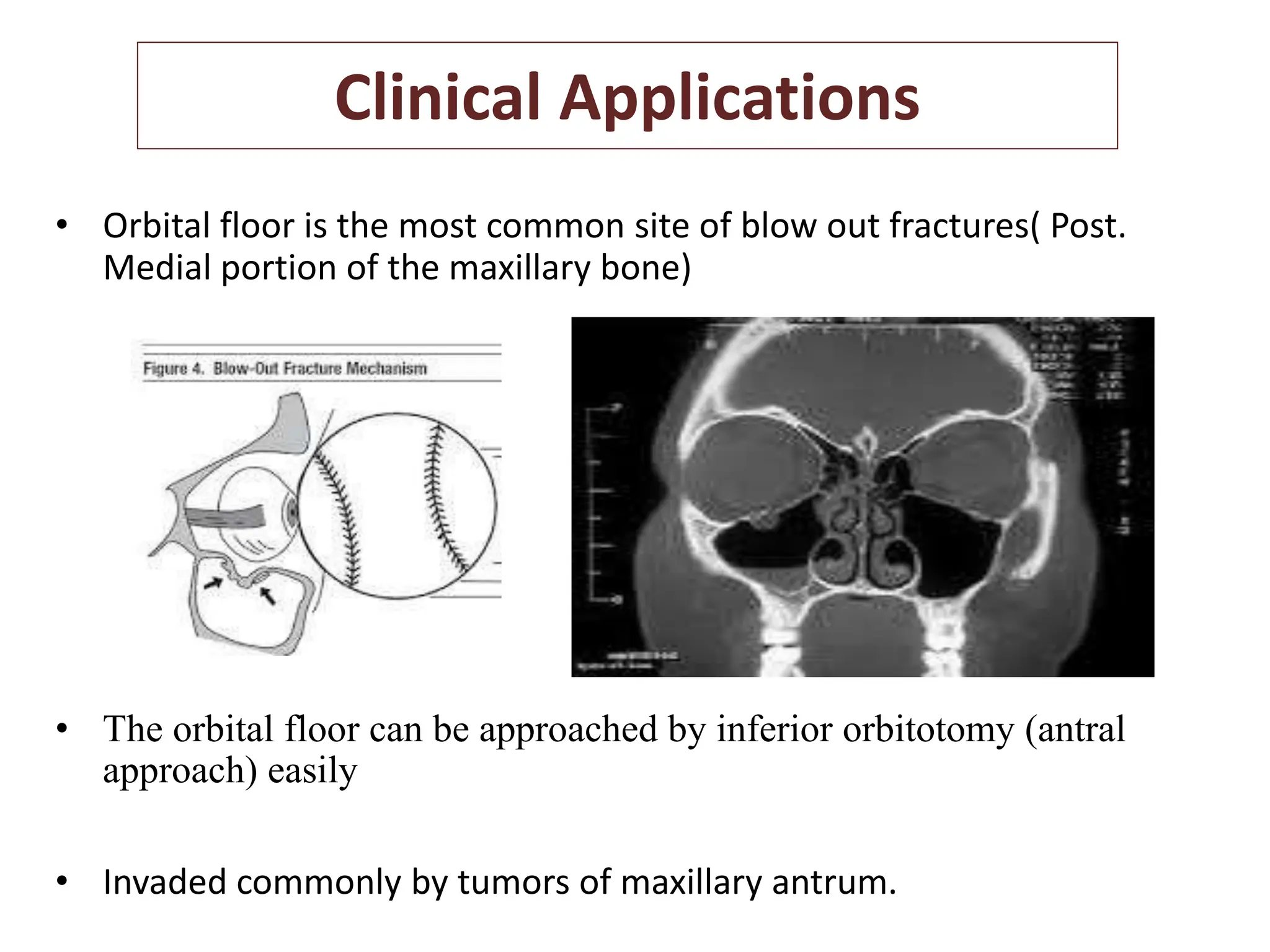 Anatomy of orbit and its clinical applications. | PPTX