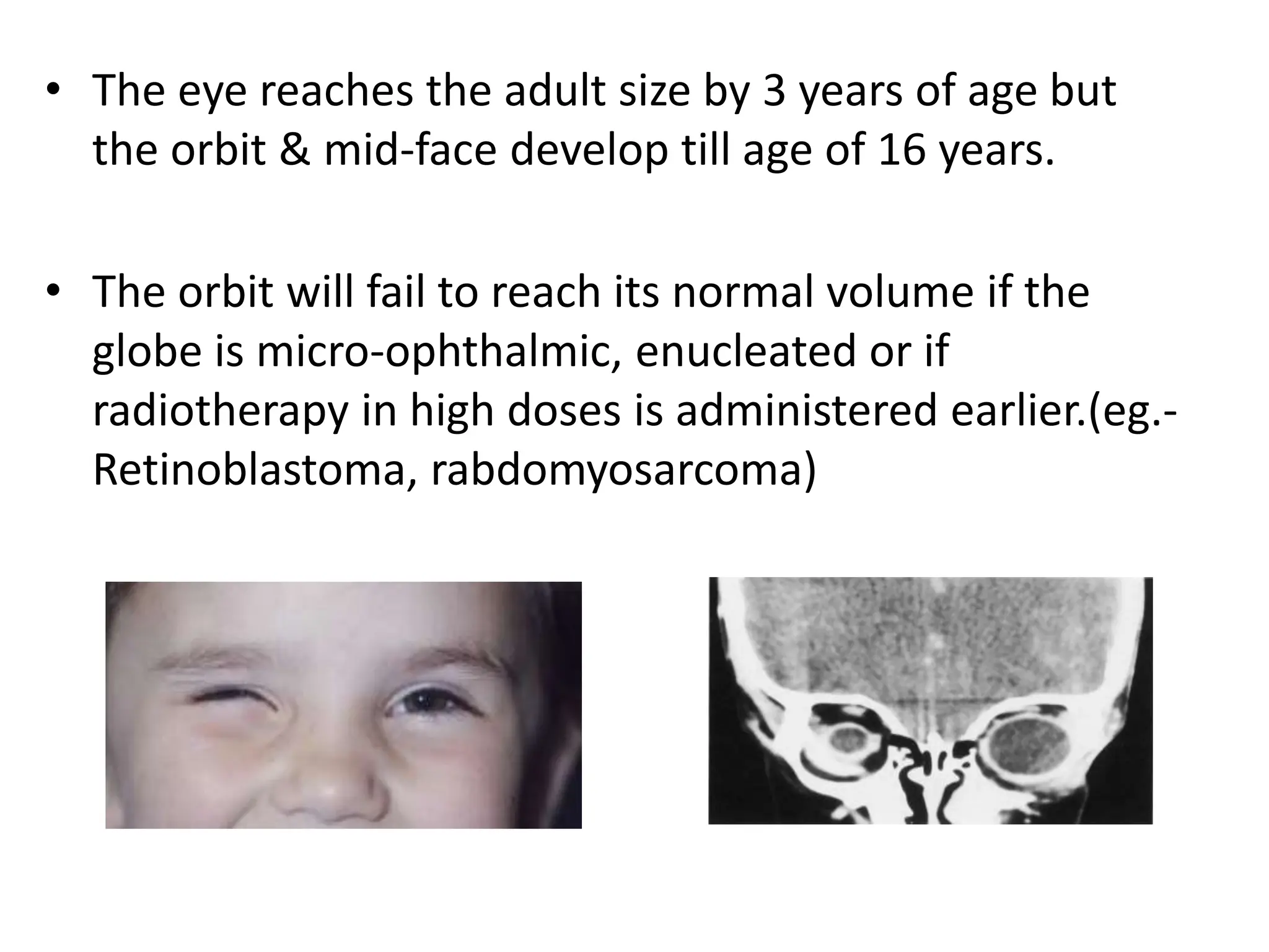 Anatomy of orbit and its clinical applications. | PPTX