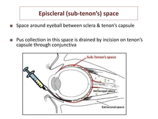 Anatomy of orbit and its clinical applications. | PPTX