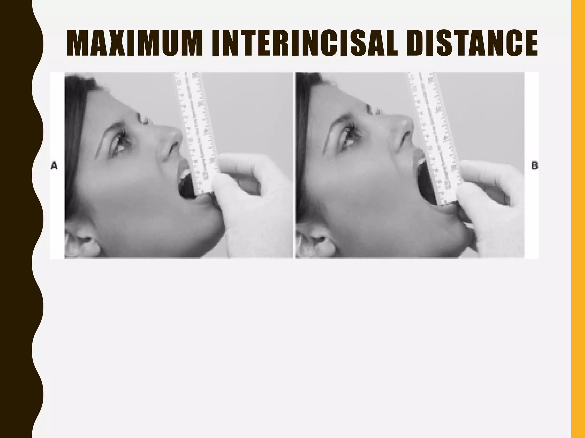 2 anatomy & physiology of tmj2 | PDF