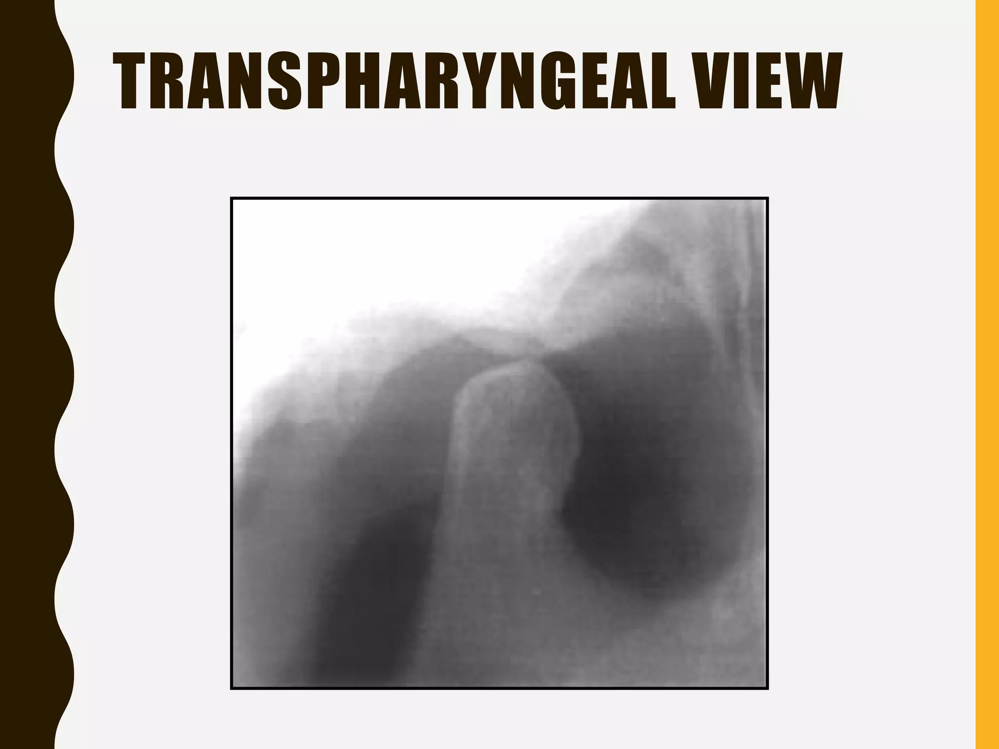 2 anatomy & physiology of tmj2 | PDF