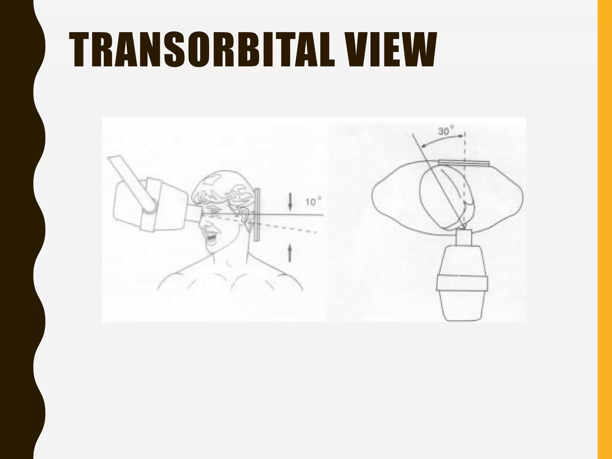 2 anatomy & physiology of tmj2 | PDF