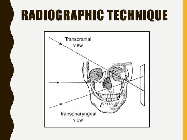 2 anatomy & physiology of tmj2 | PPT