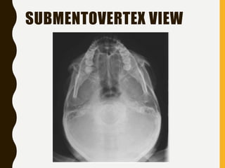 2 anatomy & physiology of tmj2 | PDF