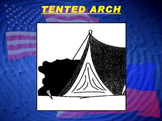 Fingerprint Classification - Arch Patterns | PPT