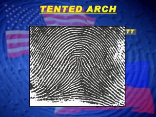 Fingerprint Classification - Arch Patterns | PPT
