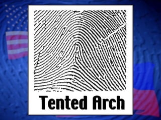 Tented Arch Fingerprint