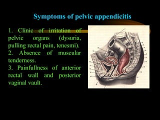 2 Appendicitis . Inflammation of appendix | PPT