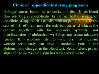 2 Appendicitis . Inflammation of appendix | PPT
