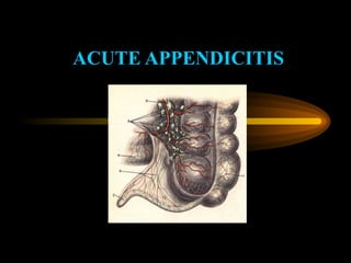 2 Appendicitis . Inflammation of appendix | PPT