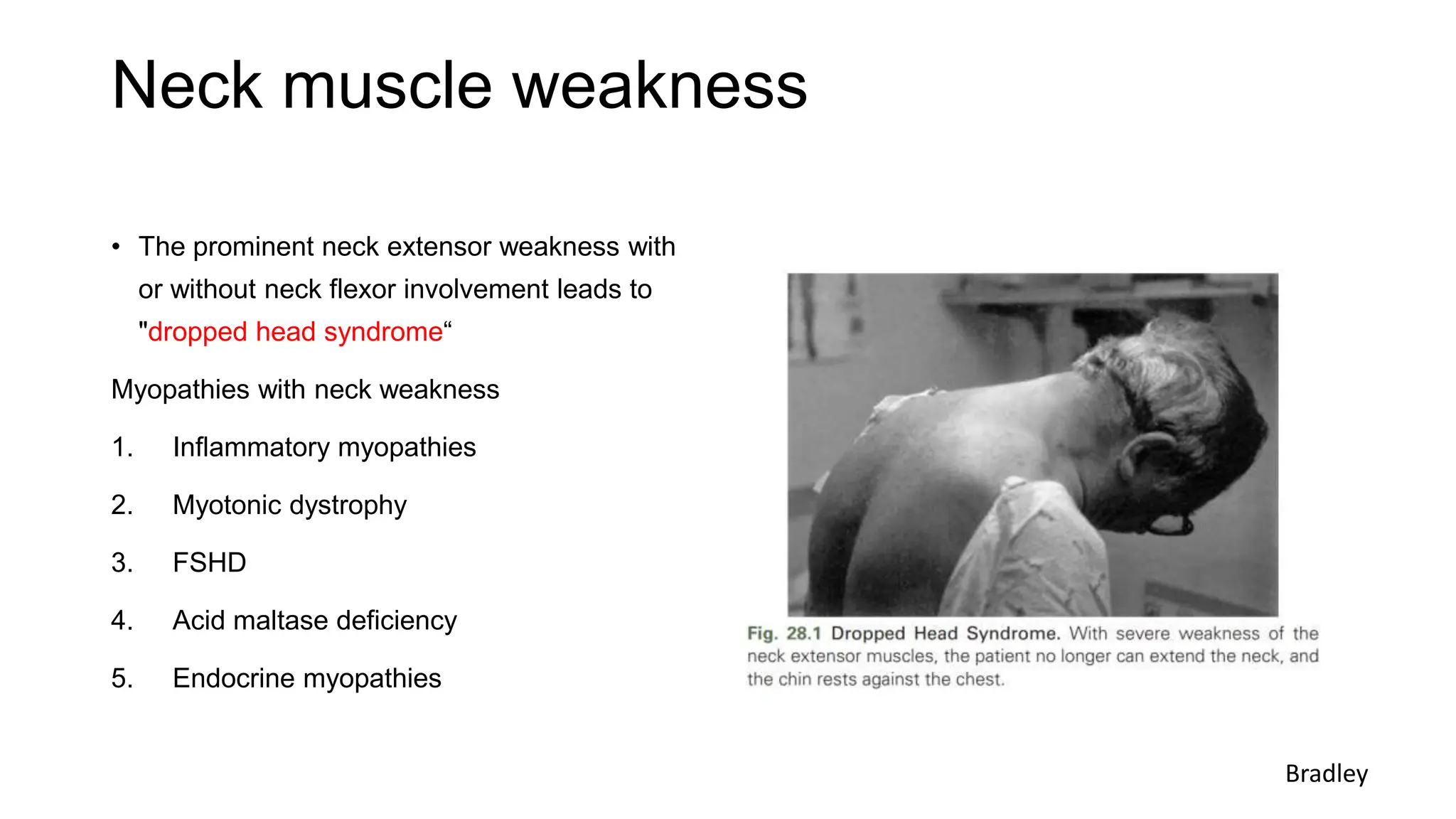 Clinical approach to myopathy and management.pptx