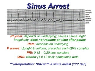 Sinus Rhythms - BMH/Tele | PPT