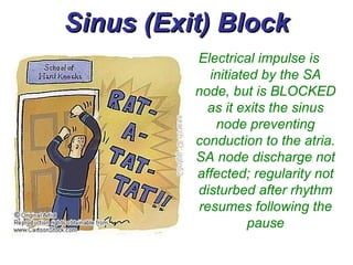 Sinus Rhythms - BMH/Tele | PPT