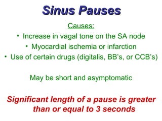Sinus Rhythms - BMH/Tele | PPT