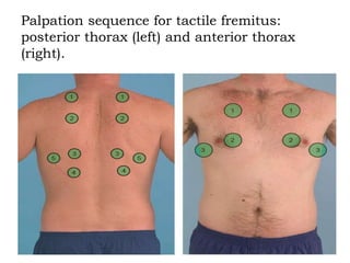 2 Assessment of patient with respiratory disorder.pptx
