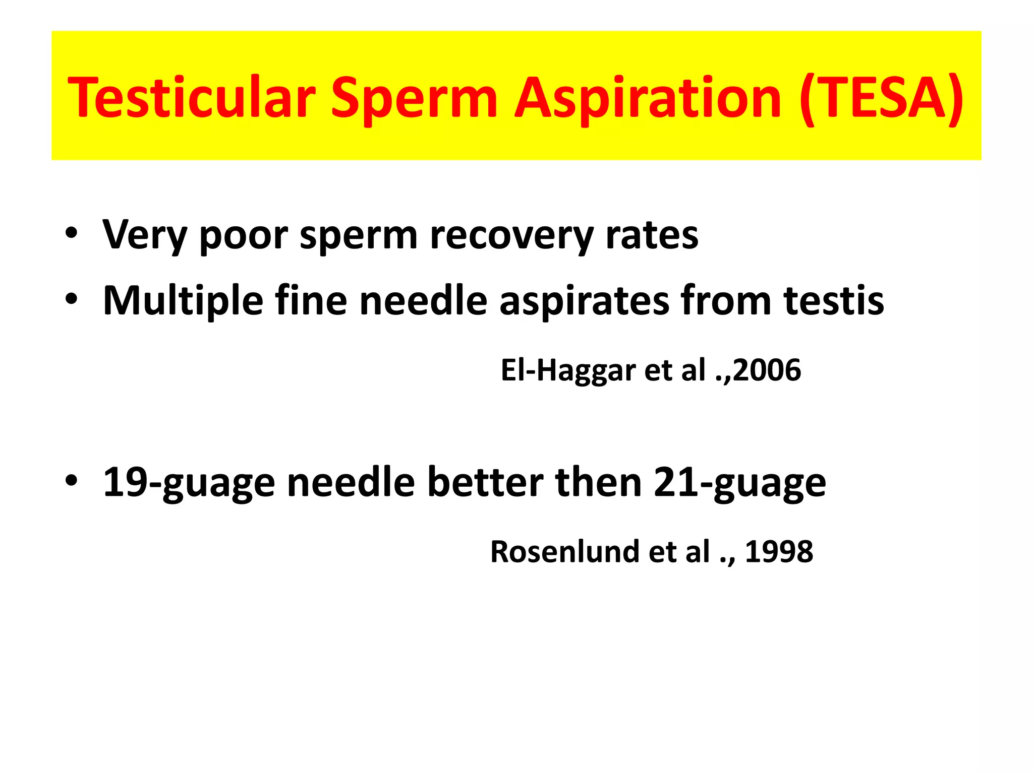 AZOOSPERMIA Management Made Simple : “Stepwise approach” | PPTX