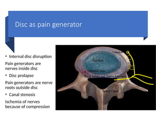 Evaluation of Back Pain: Clinical Identification of Pain Generators ...