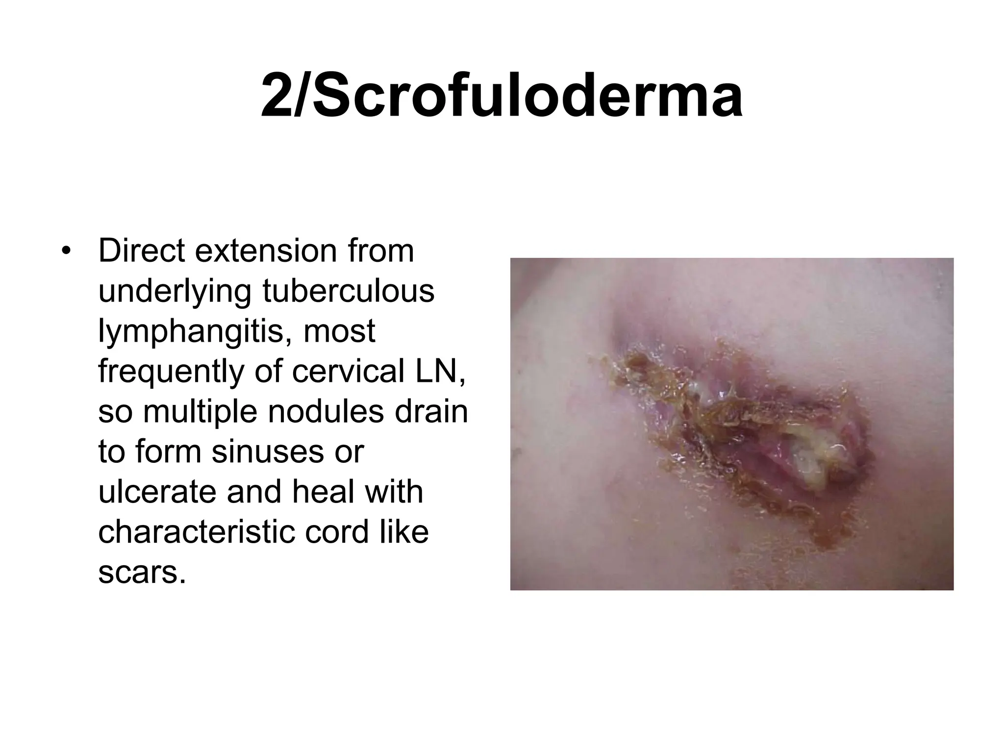 Bacterial skin infections.pptx