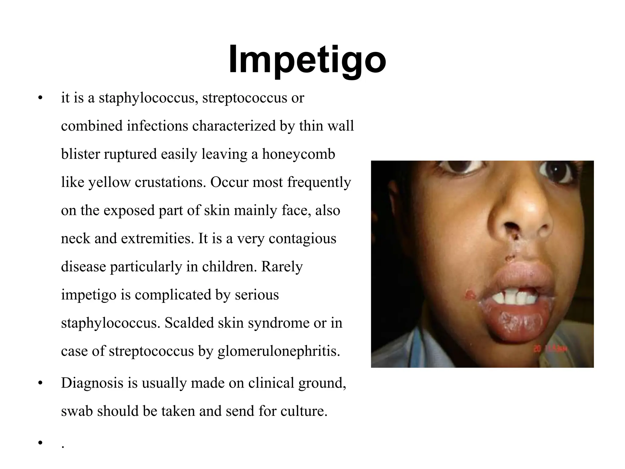 Bacterial skin infections.pptx