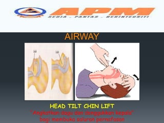2)BASIC TRAUMA LIFE SUPPORT (CPR).pptx