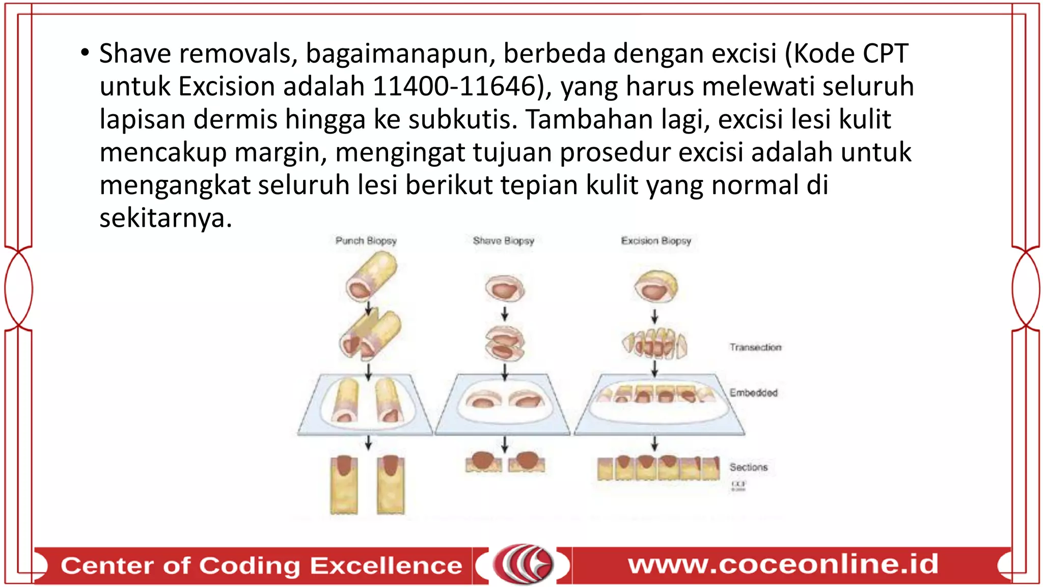 2BIOPSY VS EXCISION pdf 2BIOPSY VS EXCISION pdf