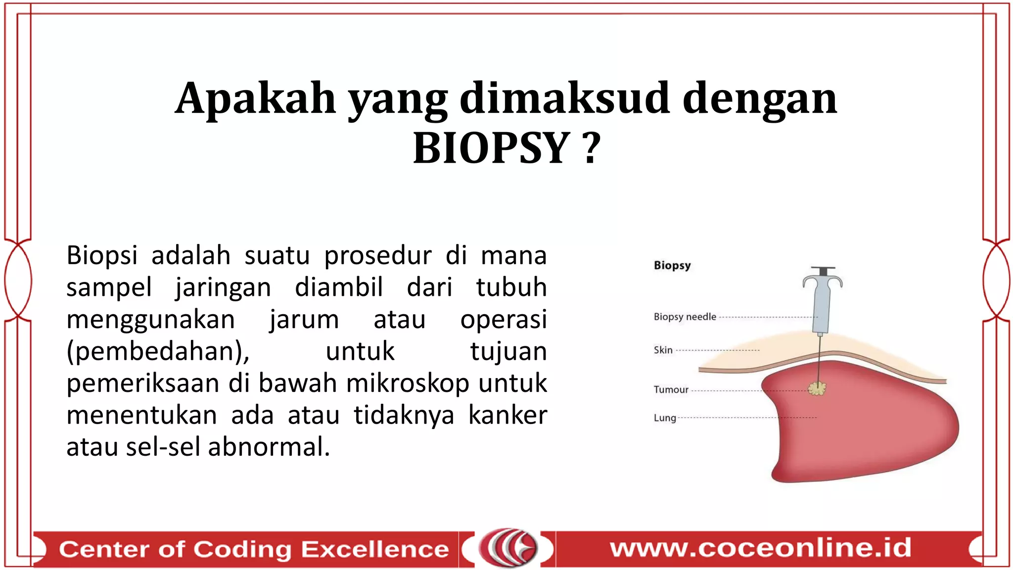 2BIOPSY VS EXCISION pdf 2BIOPSY VS EXCISION pdf