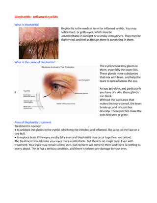 Blepharitis - patient education pamphlet | DOCX