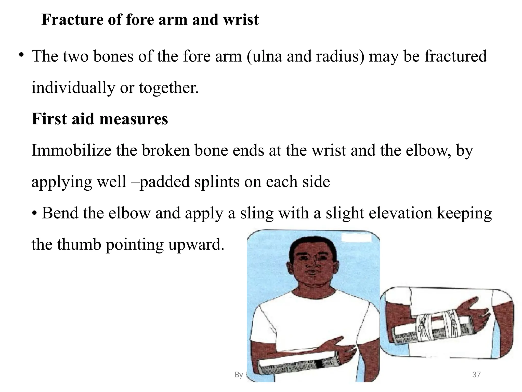 2 note on major Bone and joint injuries.pptx