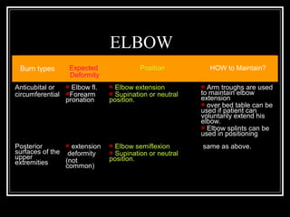 (2) burn rehabilitation | PPT