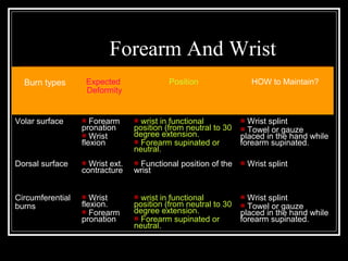 (2) burn rehabilitation | PPT