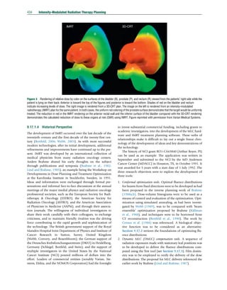 IMRT | PDF | 3-D Graphics | Computer Software and Applications