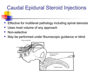 Spinal_Injections_v2_LinkedIN | PPT