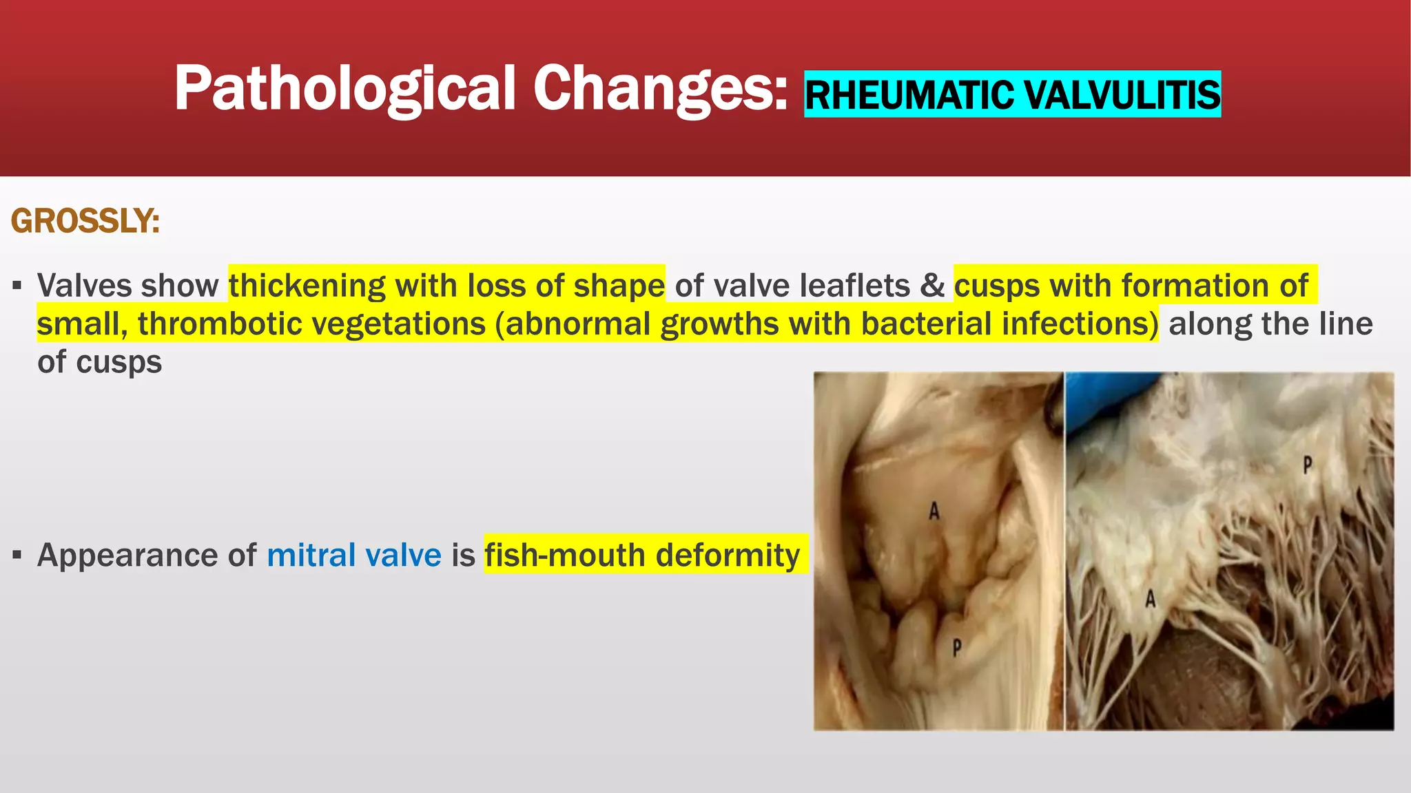 CARDIAC DISORDERS | PPTX