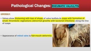 CARDIAC DISORDERS | PPTX